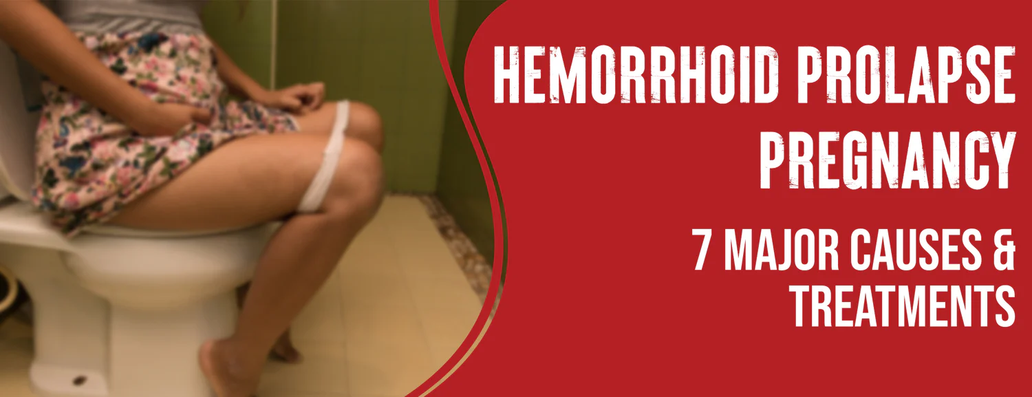 Hemorrhoid Pregnancy Prolapse: 7 Major Causes & Treatments