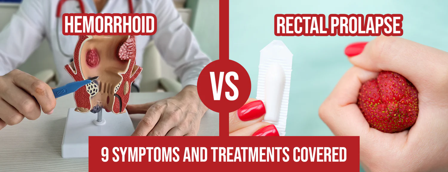 Hemorrhoid vs Rectal Prolapse: 9 Symptoms & Treatments