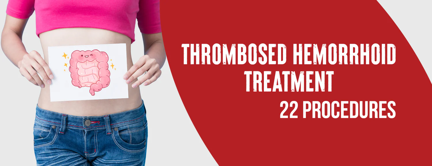 Thrombosed Hemorrhoid Treatment: 22 procedures